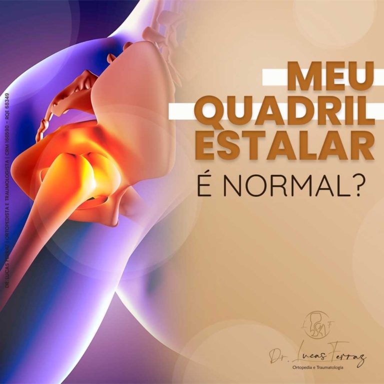 Meu quadril estalar é normal? - Dr. Lucas Ferraz
